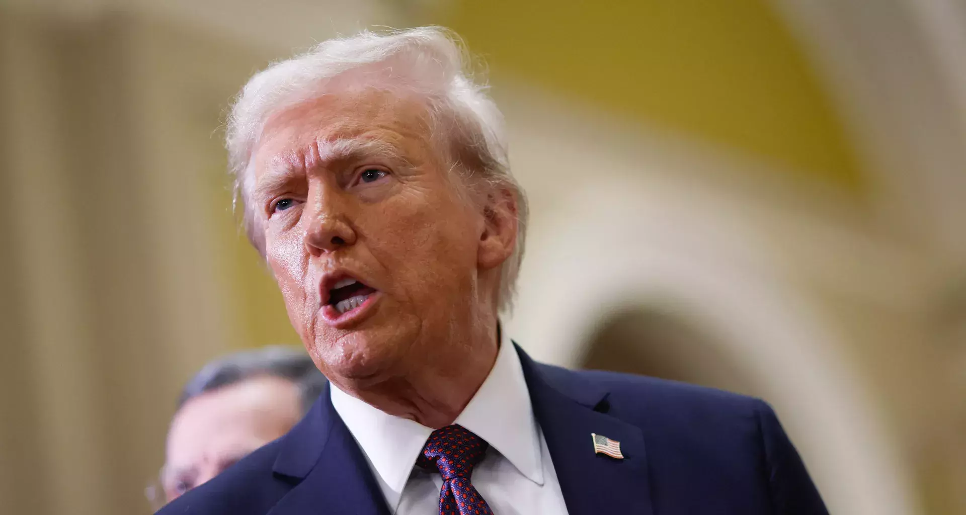 Donald Trump diagnosticeret med kronisk venøs insufficiens efter at have bemærket hævede ben ...